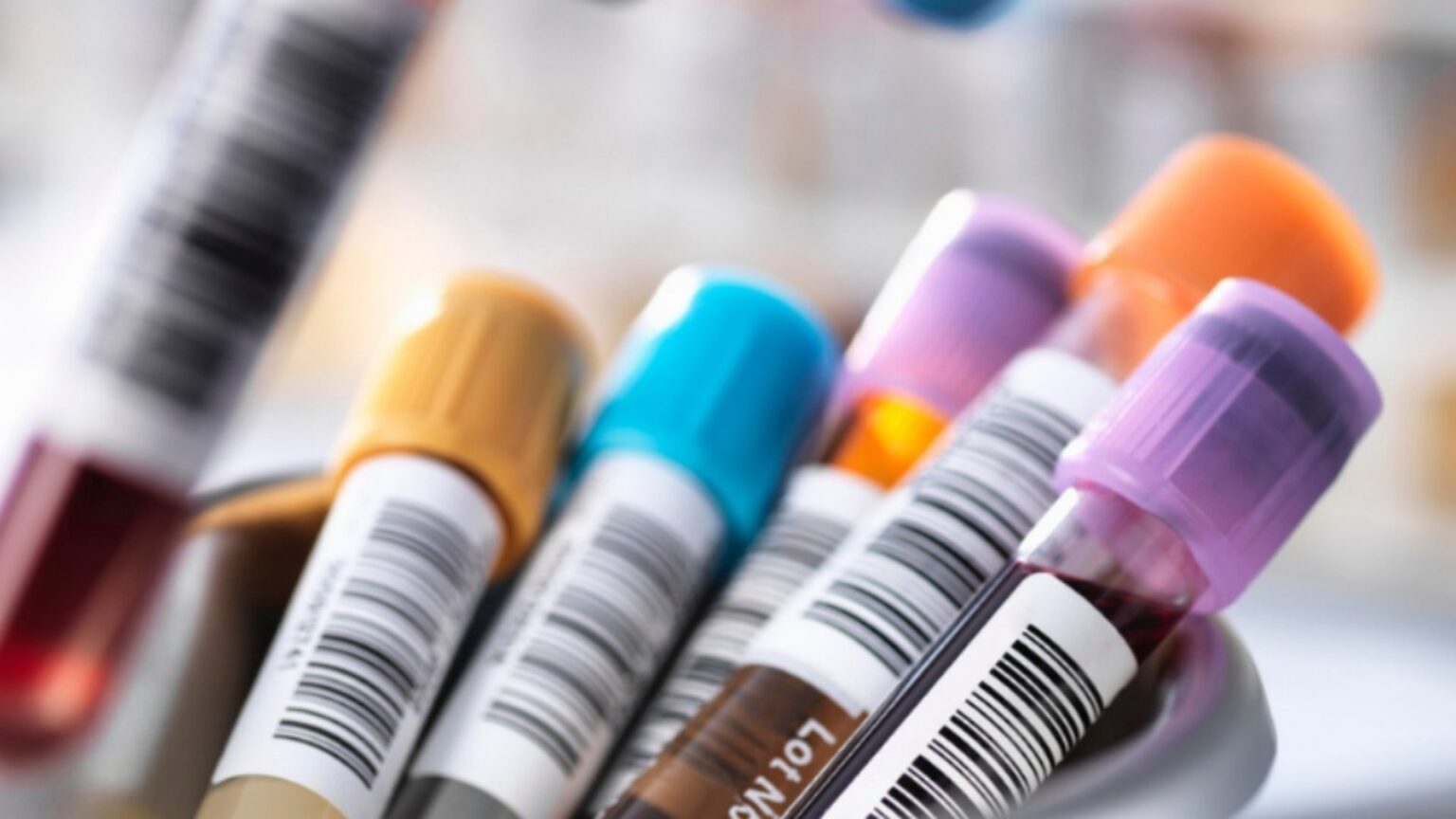 Customizing Solutions for Forensic Lab Instrument Challenges in Laos ...